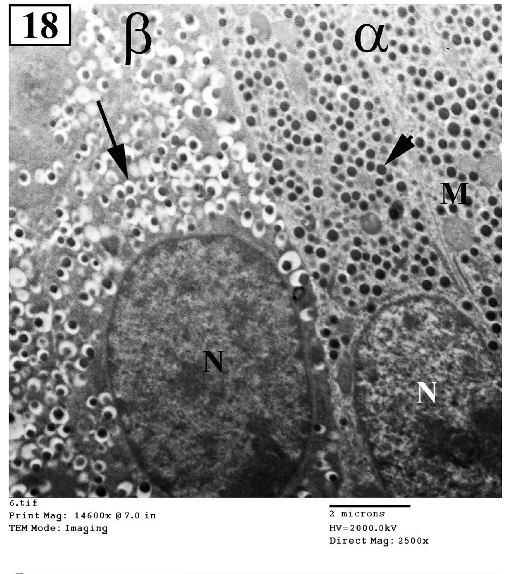 An electron micrograph of the pancreas of the resveratrol