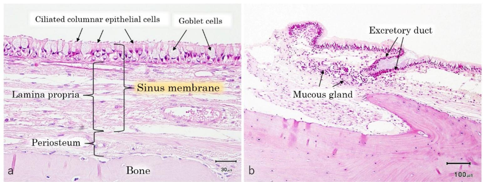 Histological structure of the sinus membrane figure 6. the