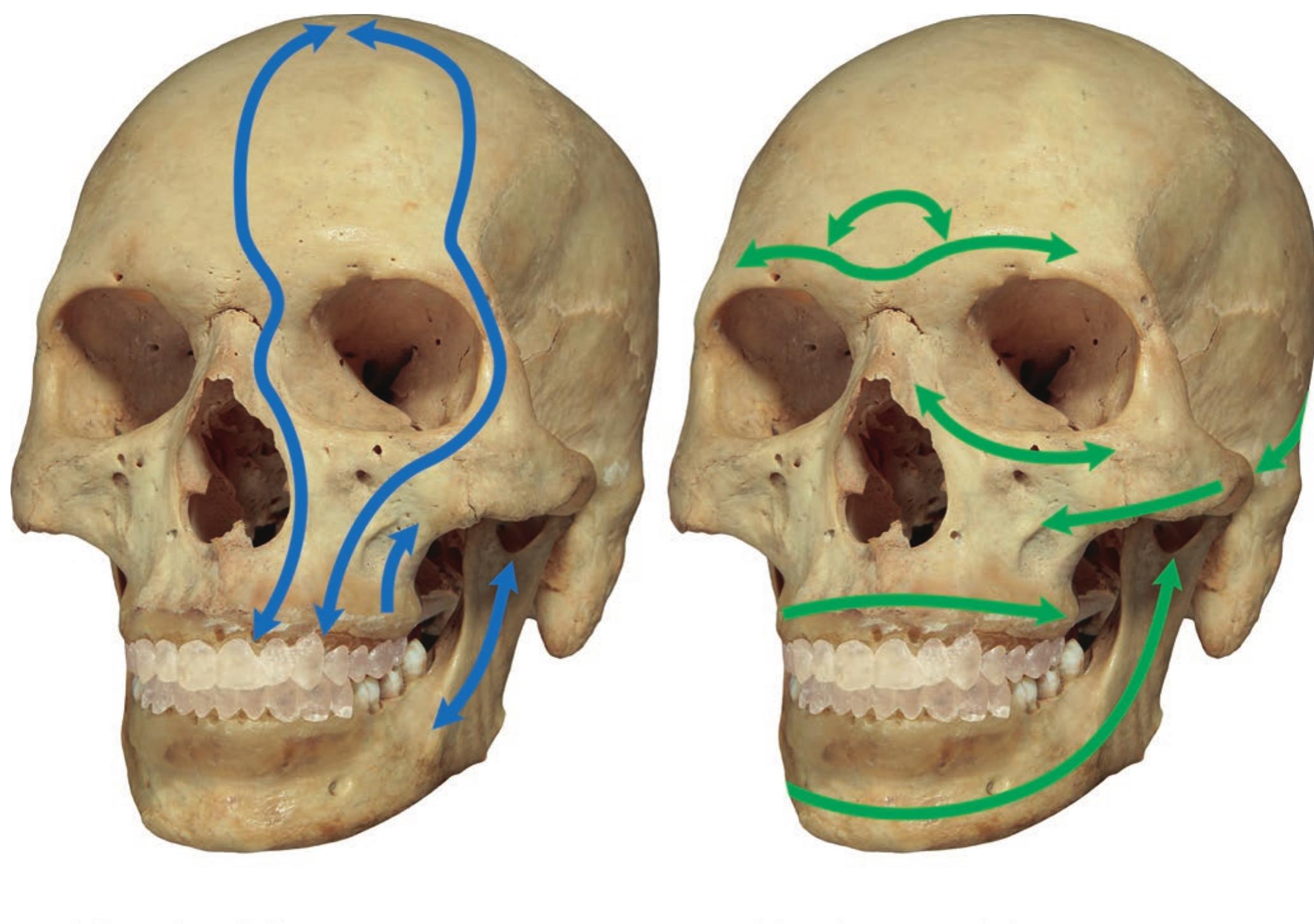 2 vertical and horizontal buttresses of the facial skeleton