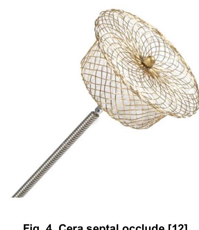 Figure 5 - Transcatheter Closure of Atrial Septal Defect