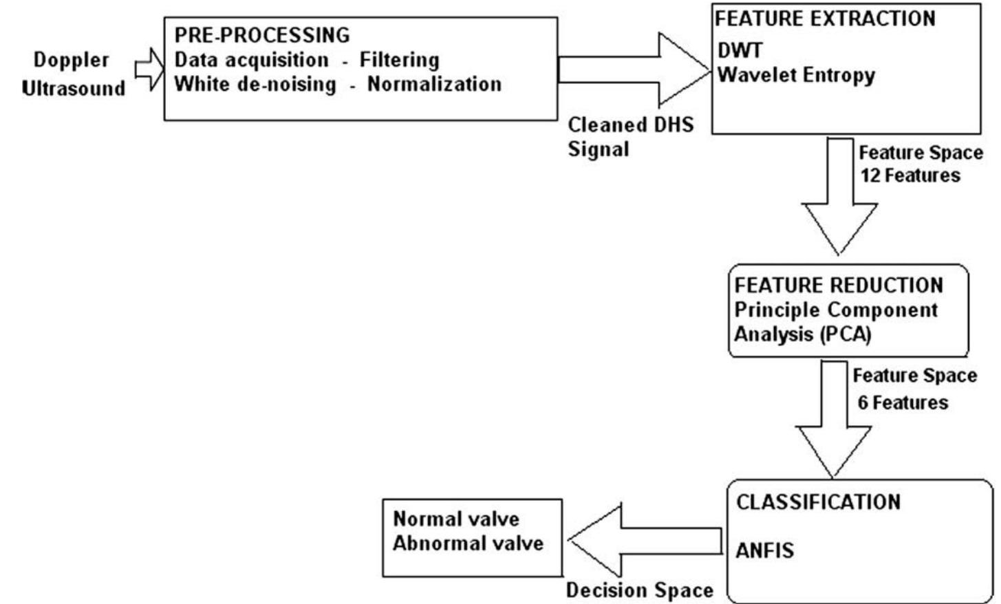 The block diagram of the pca—-anfis intelligent diagnosis