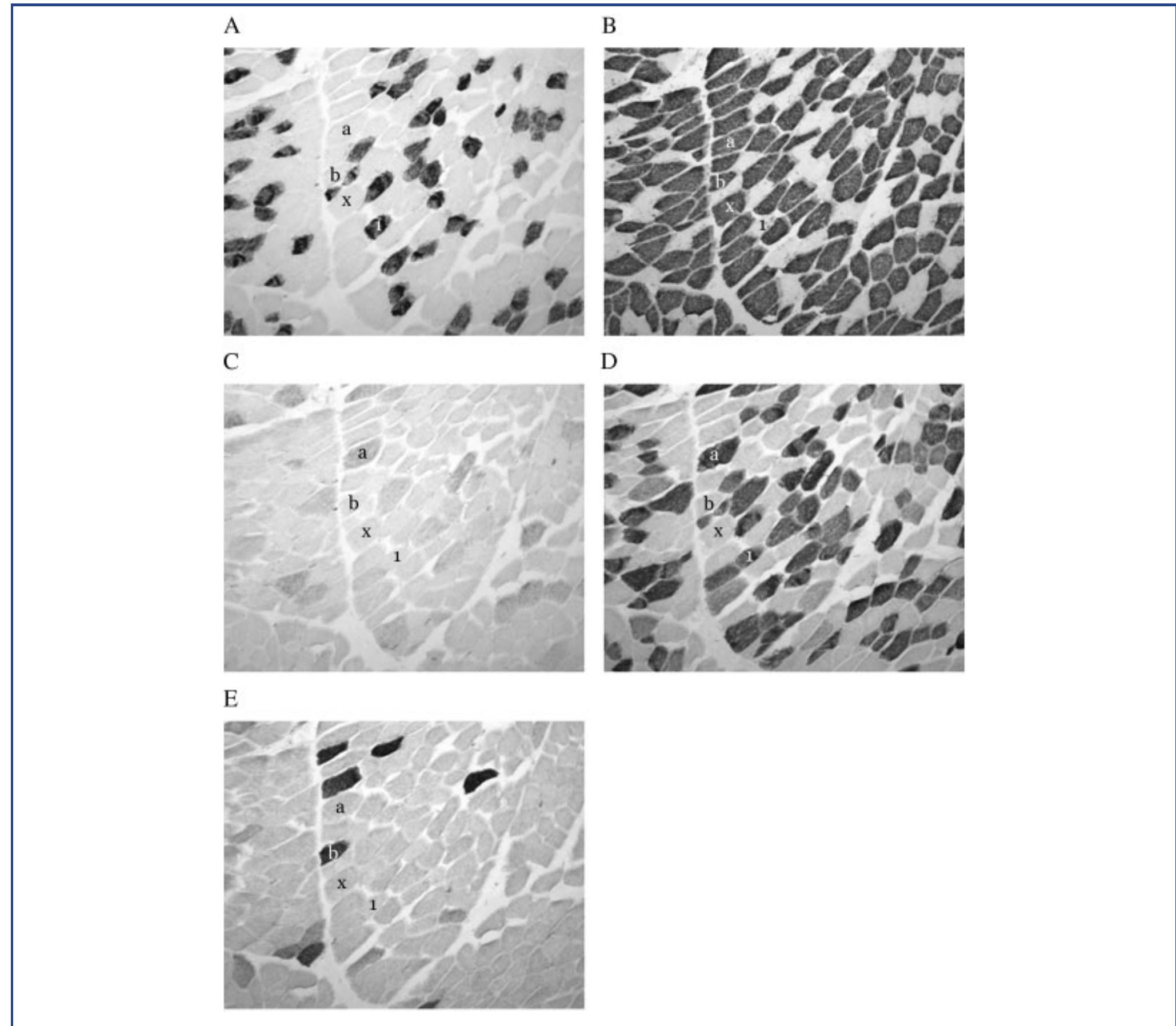 Serial cross sections of a tiger mg (superficial region)
