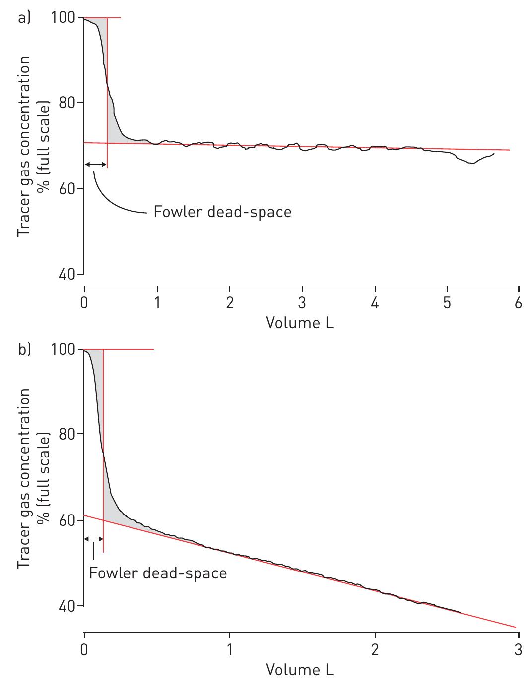 (PDF) 2017 ERS/ATS standards for single-breath carbon monoxide uptake ...