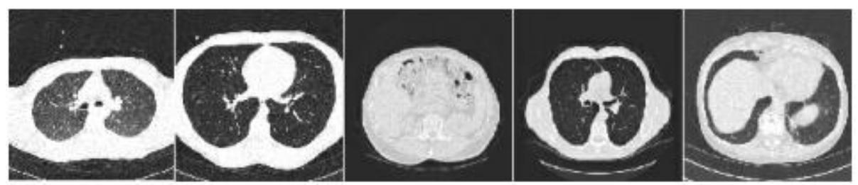 Sample images from exact09-ct dataset. exacto09 is a chest