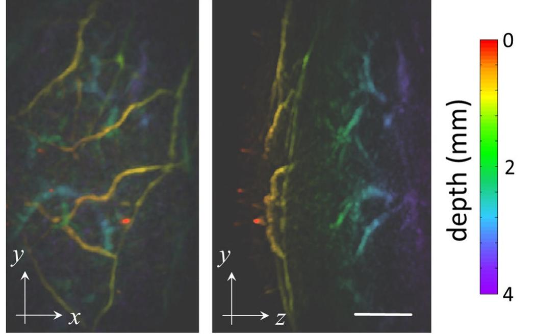 Deep-tissue imaging of mouse microvasculature in vivo.