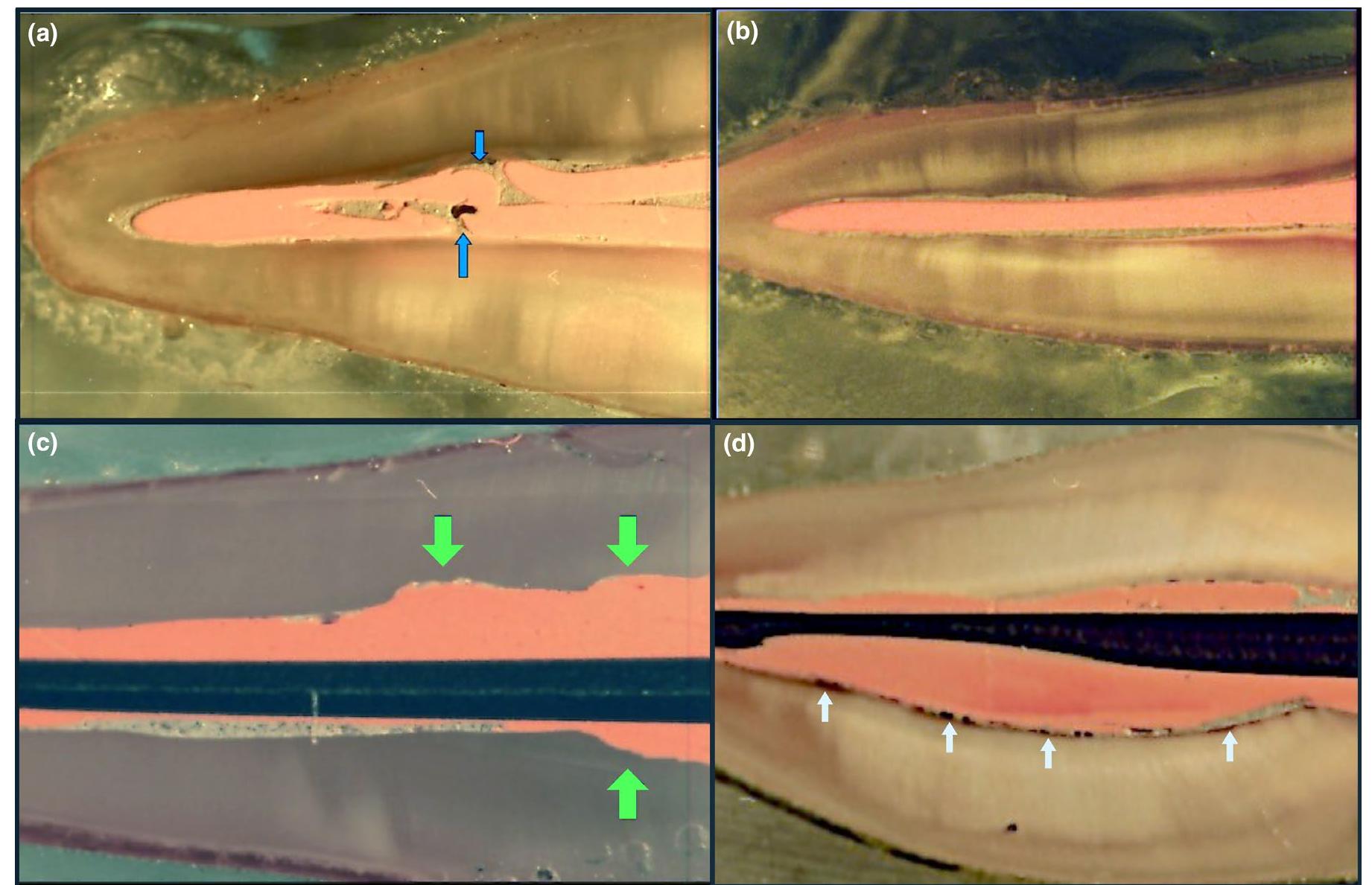 Representative longitudinal cross-section images of