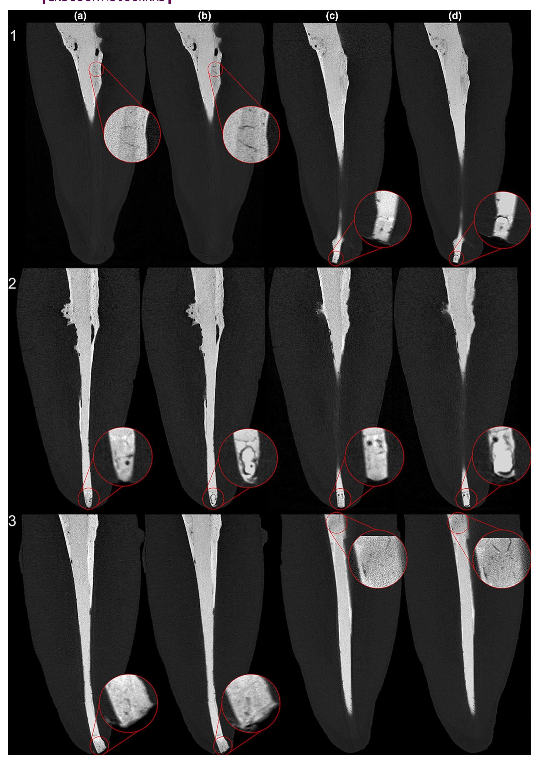 Micro-ct sagittal cross-section images of three