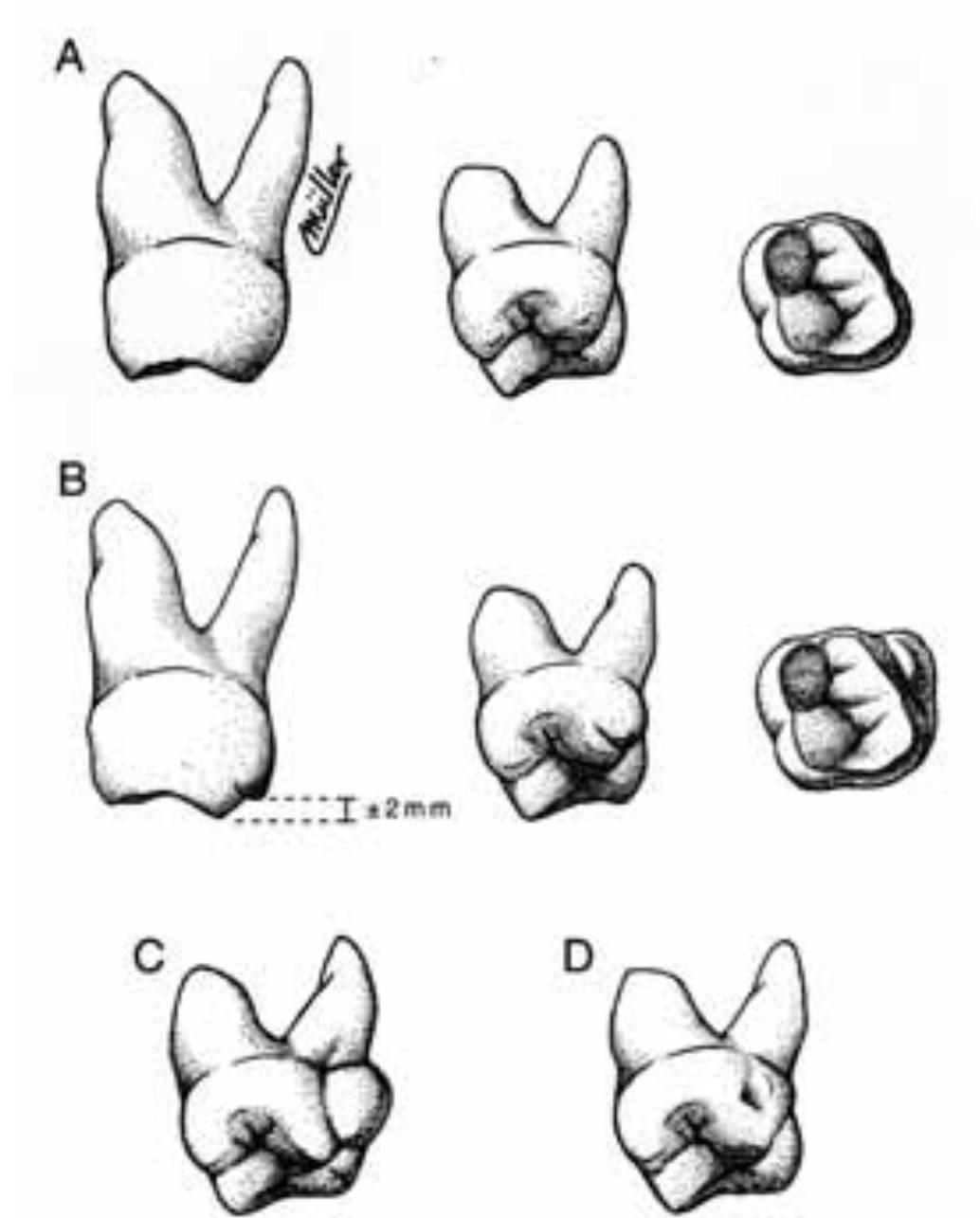Views of a maxillary molar showing (a) mesial,