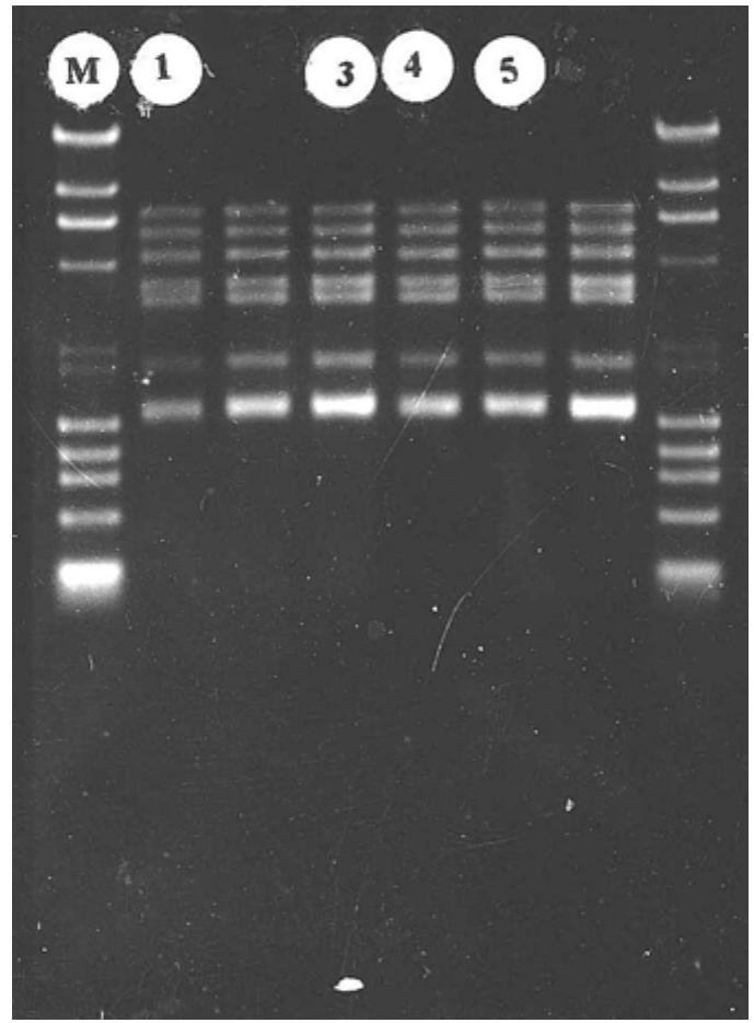 Restriction Enzyme Cleavage Pattern Of Eds Viral Dna Lanes
