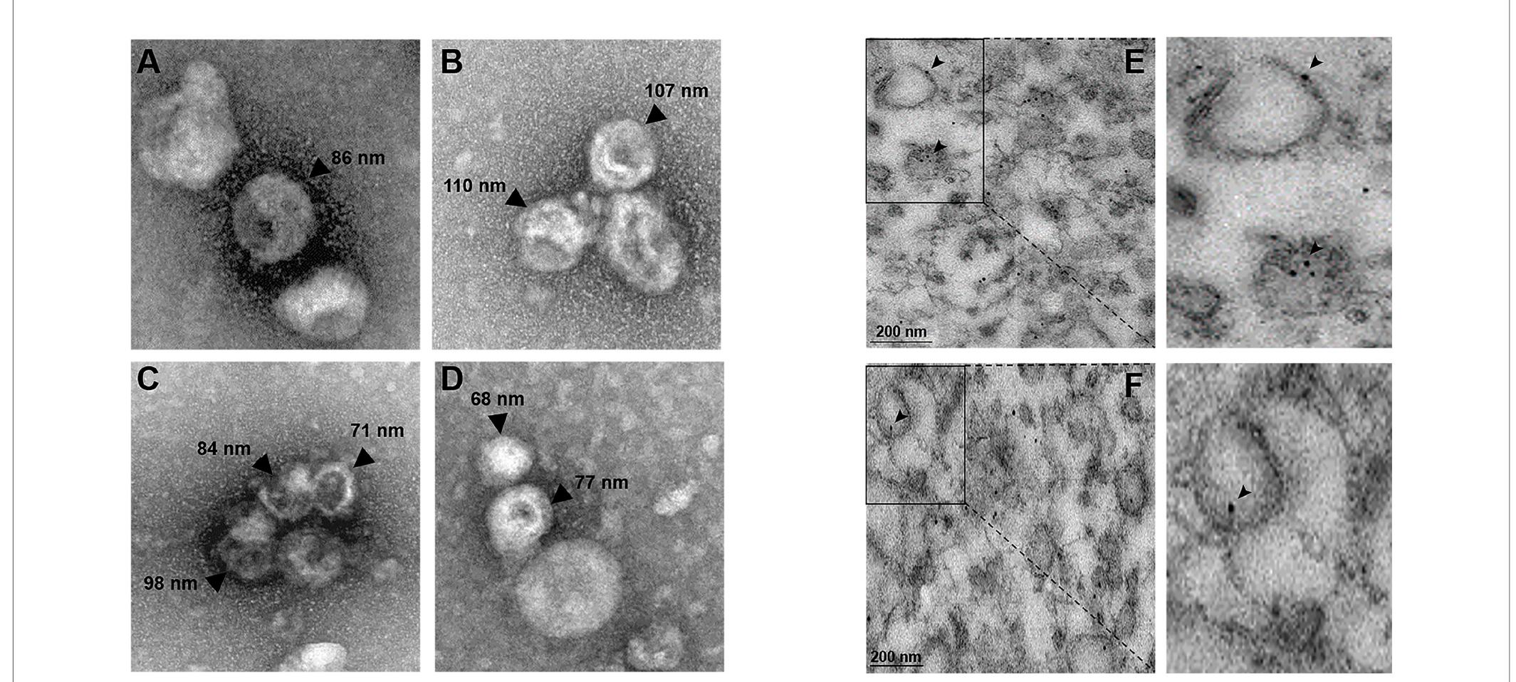 | transmission electron microscopy of vesicles found in