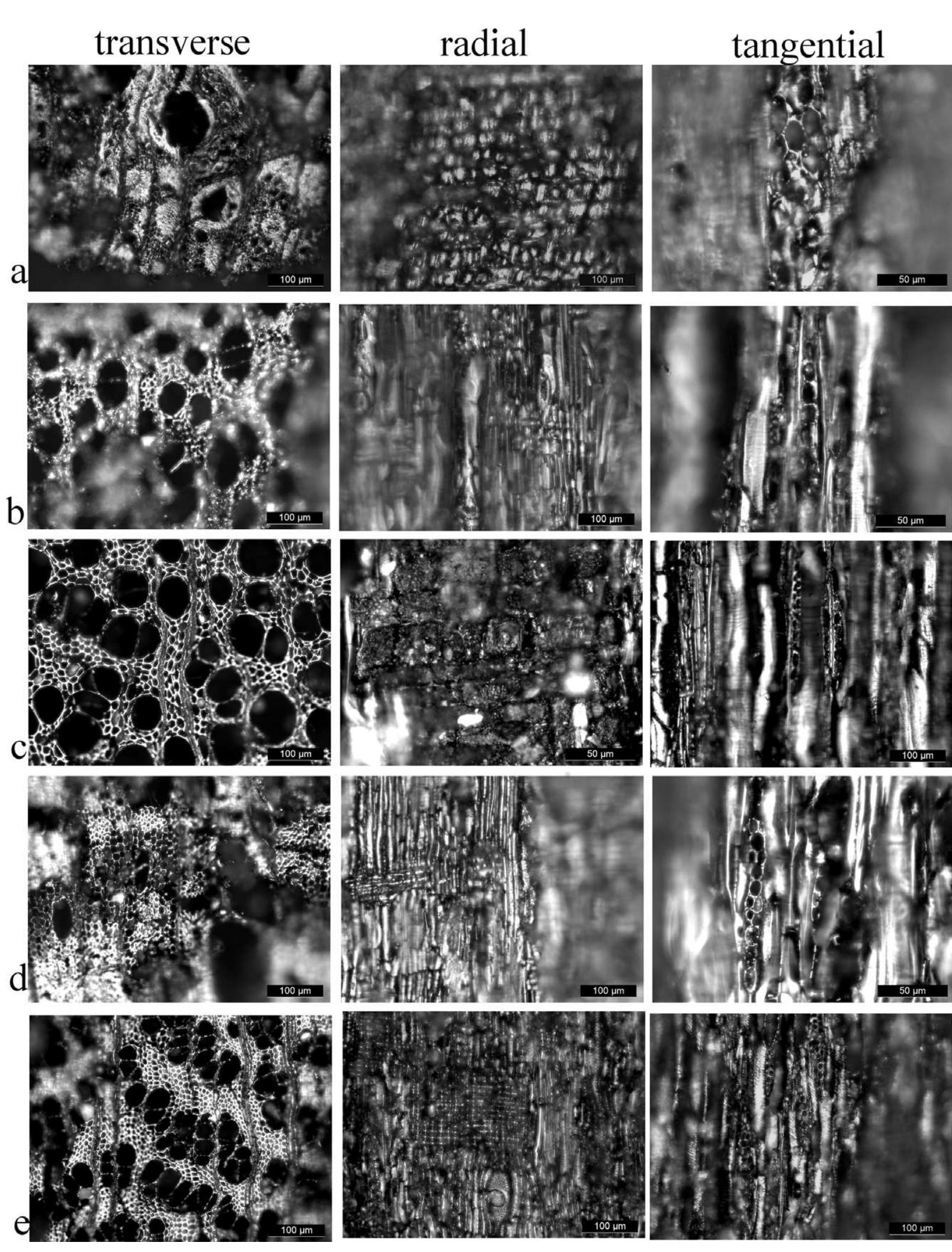 Transverse, radial, and tangential anatomical cuts of