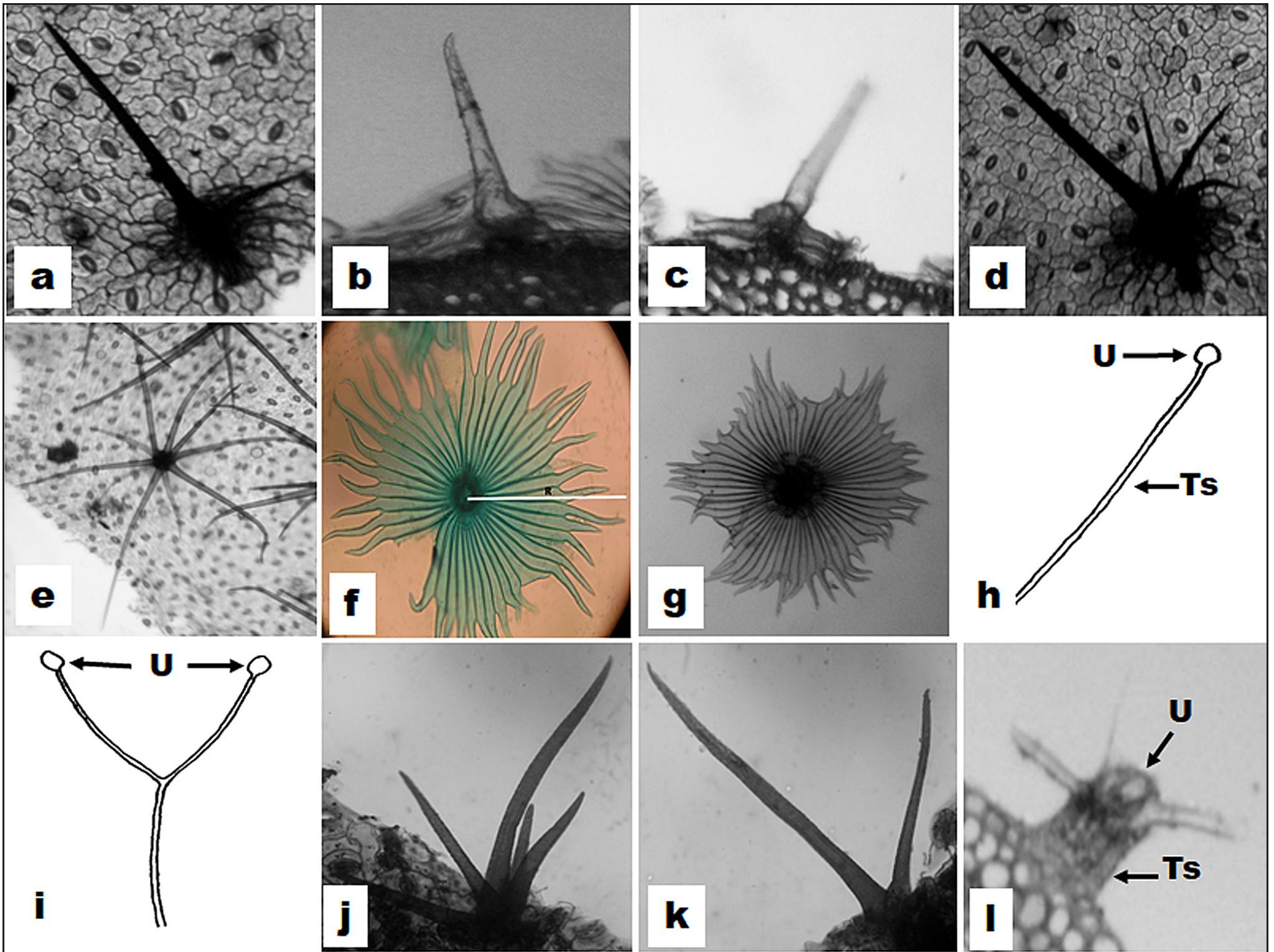 Variations in trichome morphology observed across the croton