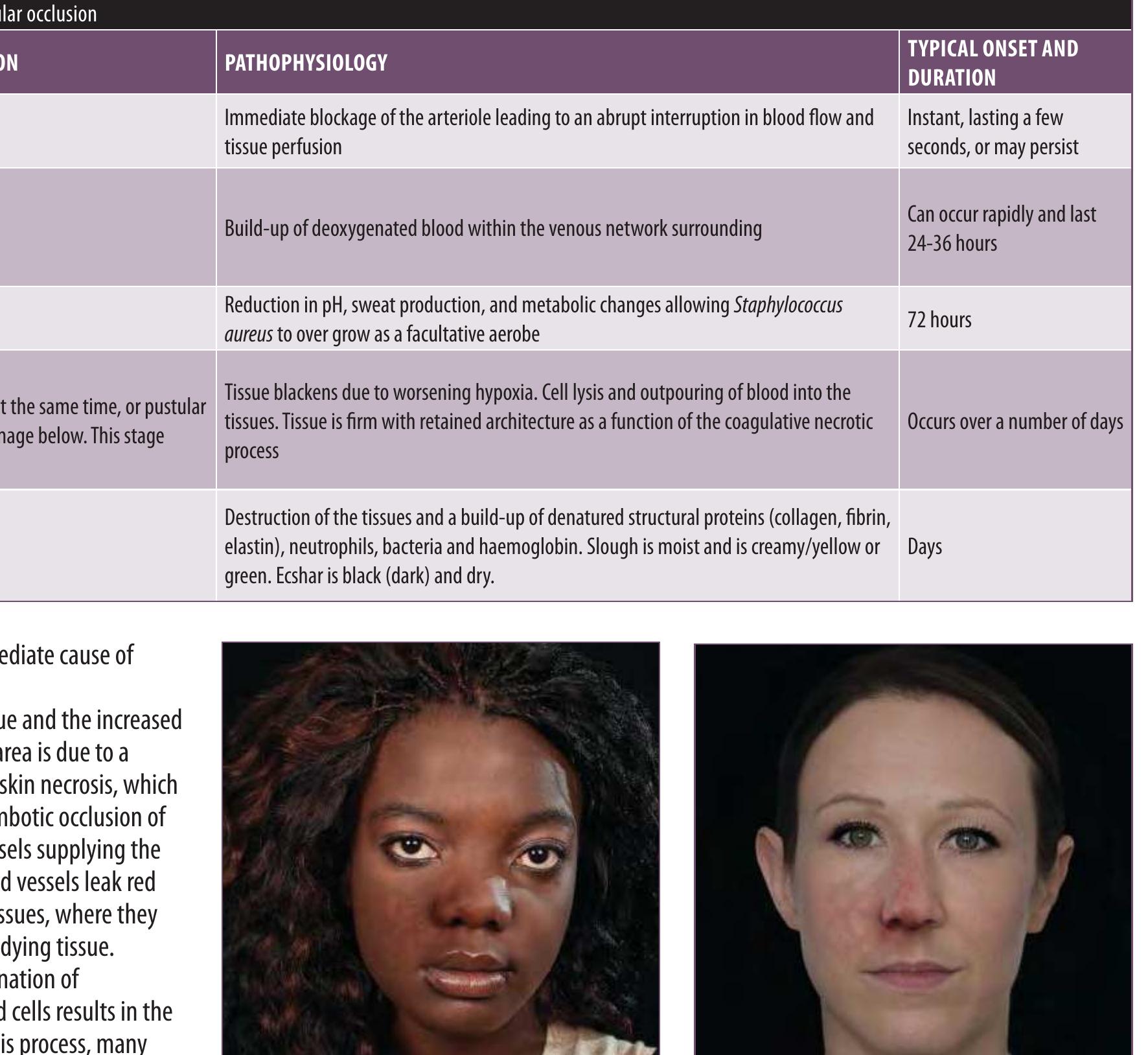 Figure 6 - from Guideline for the Management of Hyaluronic