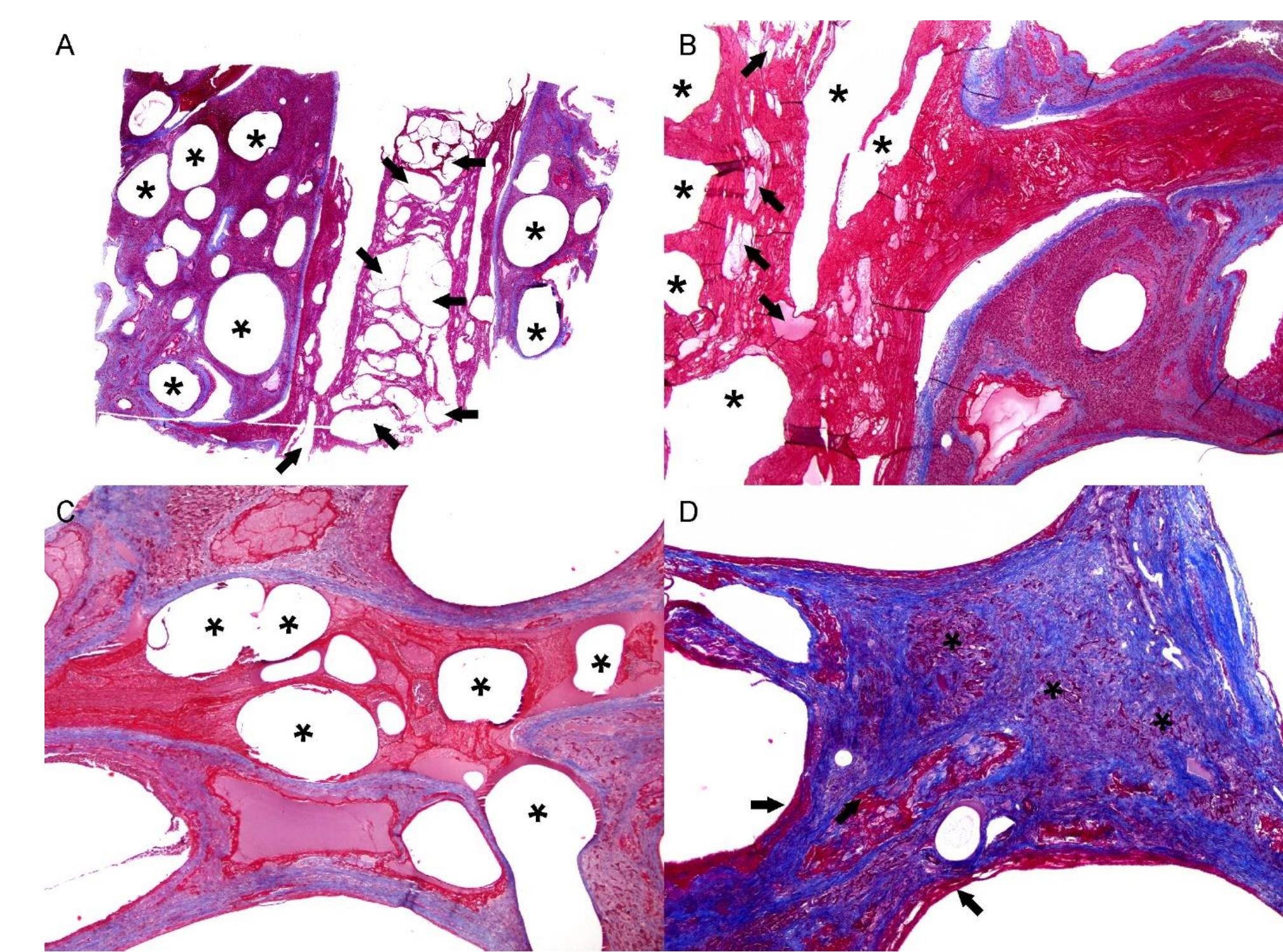 Histochemical features of cystic liver lesions in dolphins.