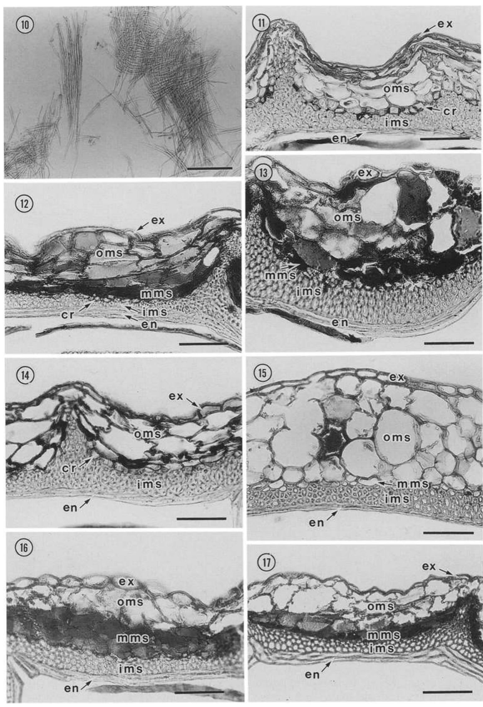 Figure 2 - Pericarp anatomy and evolution inCoriaria