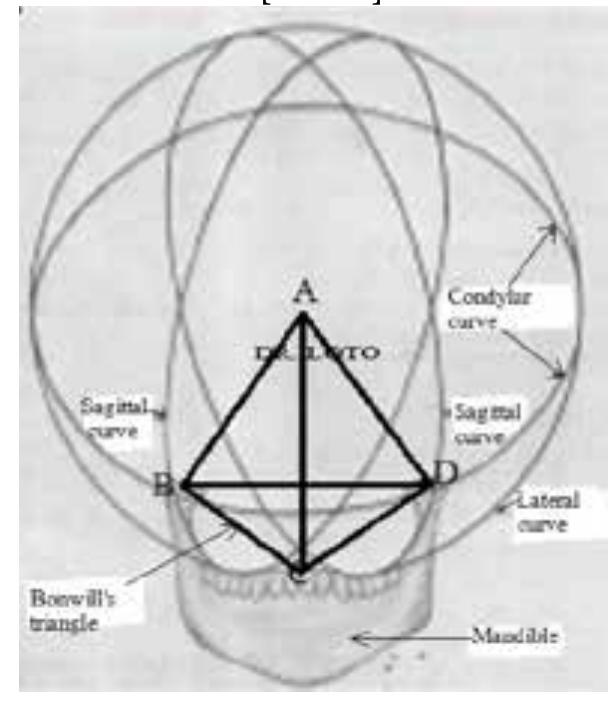 Showing formation of monson’s pyramid and pyramid can be