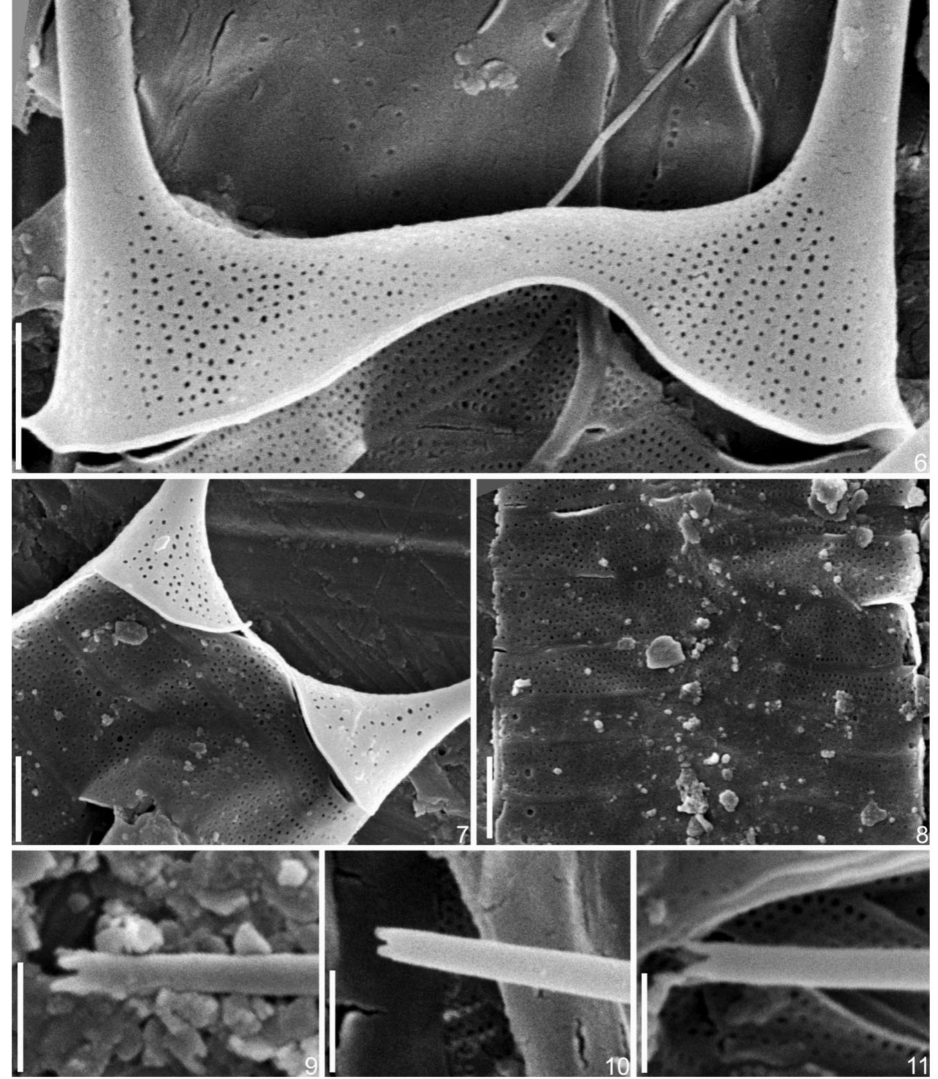 Figure 3 - from Acanthoceras and Urosolenia species