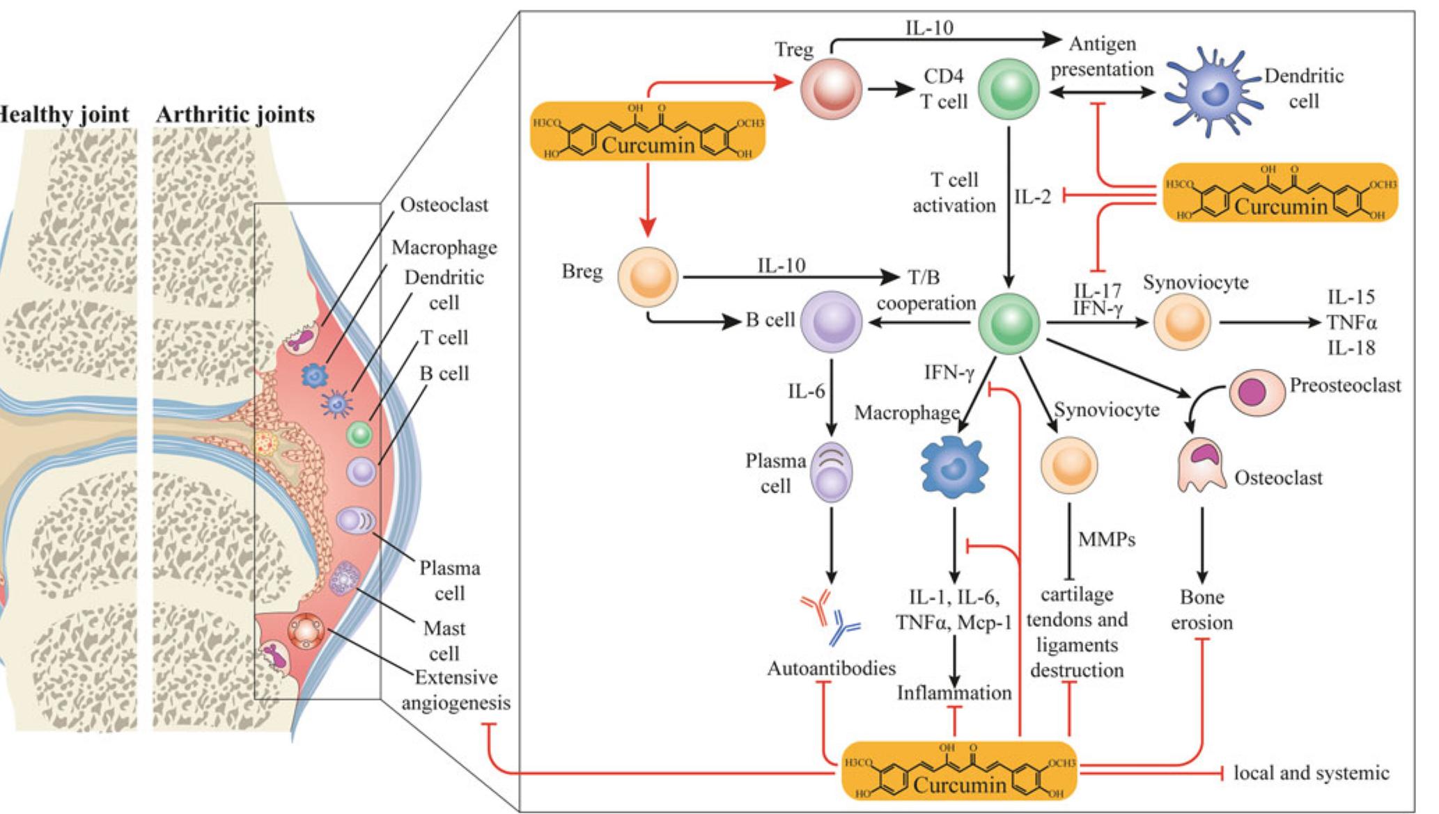 A schematic view of curcumin’s immunomodulatory effects on