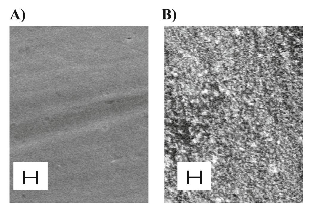 Scanning electron micrographs (sems) of a the bare au
