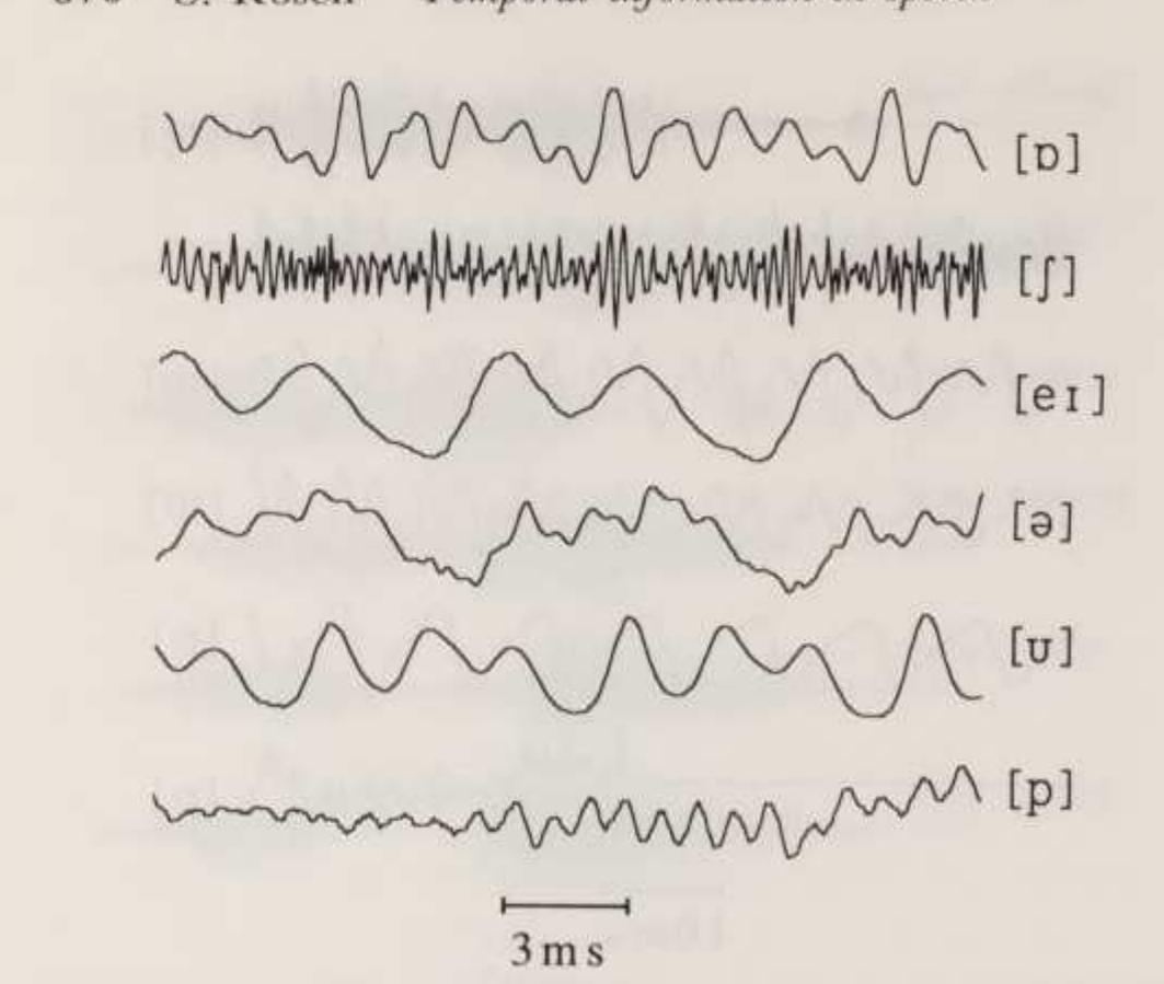 Sections of the speech pressure waveforms of figure 1,
