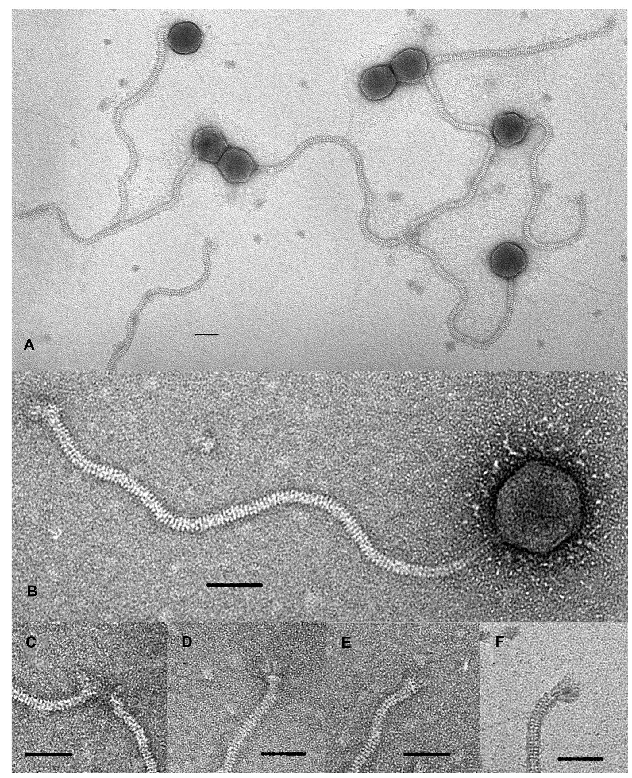 Transmission electron microscopy of bacillus phage izhevsk