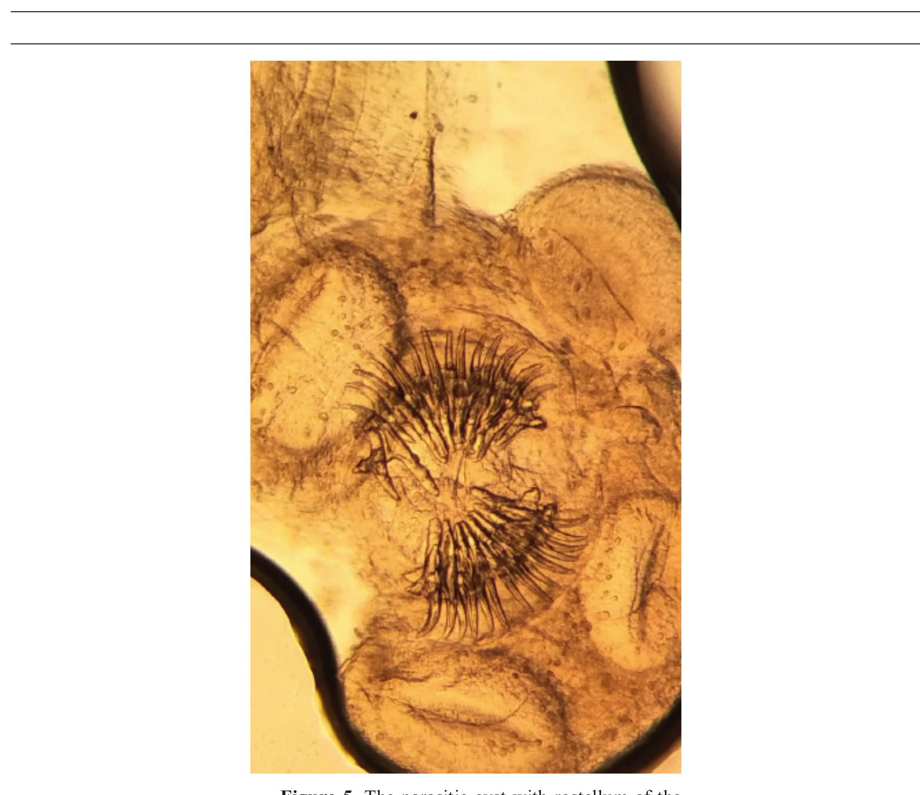 Figure 5 - Laparoscopic Retrieval of Abdominal Cysts in