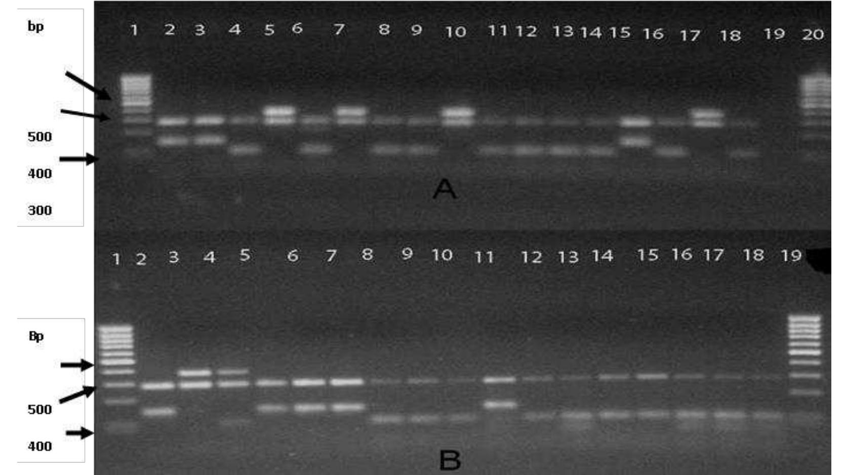 Jure 3. sample of multiplex pcr gel showing the different