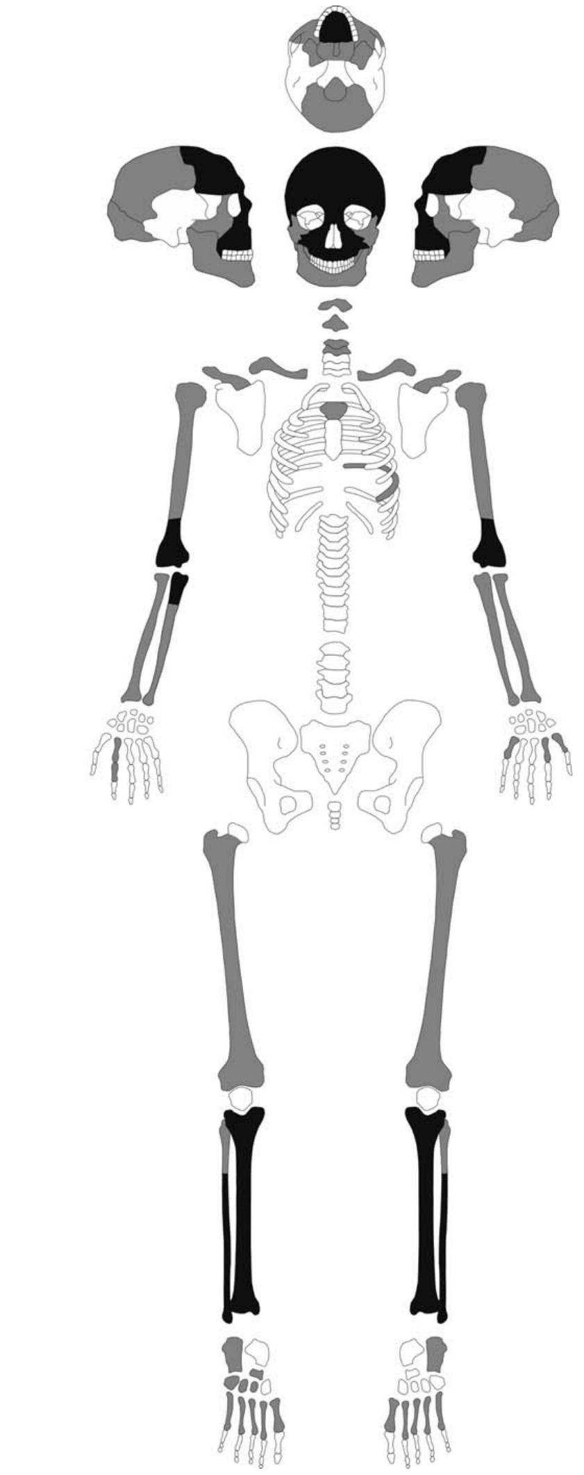 Figure 10 - from Evidence of skeletal treponematosis from
