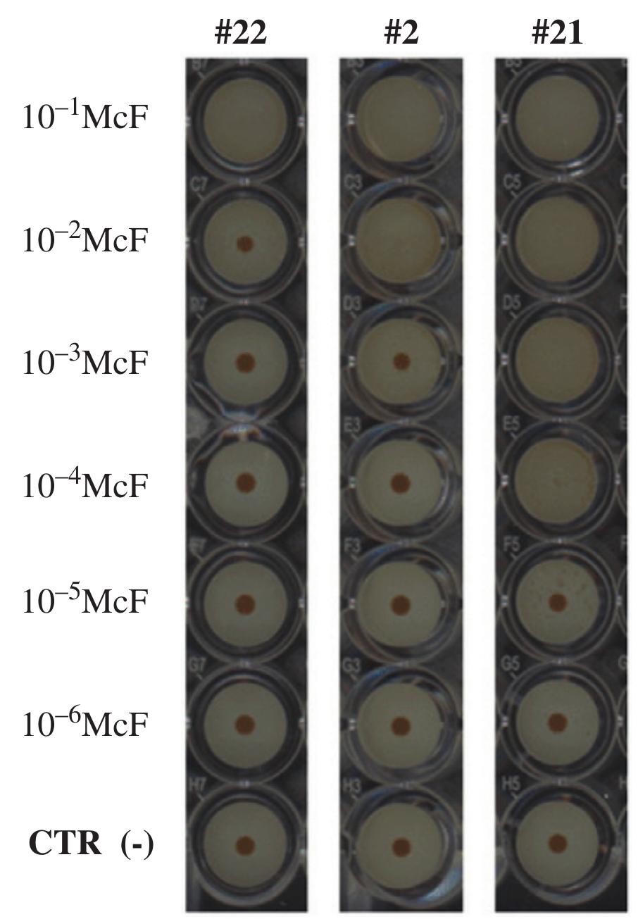 Biofilm profiling of pseudomonas aeruginosa clinical