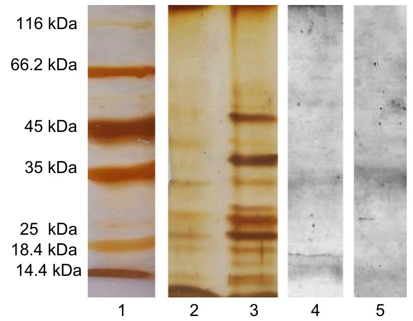 Sds-page of keratinase and disulfide reductase from bacillus