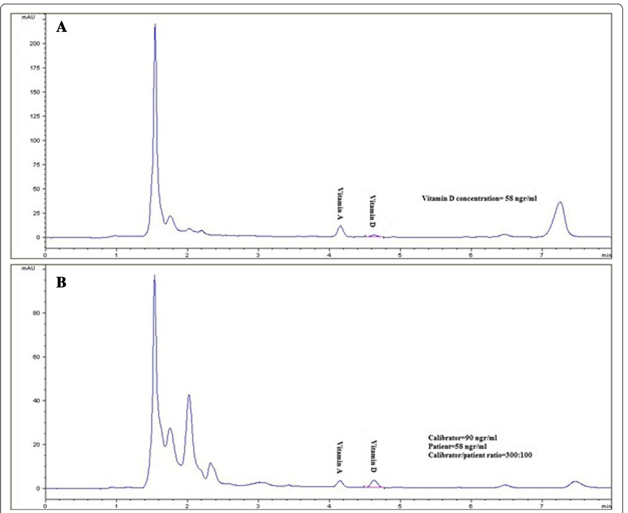 Hplc chromatograms of a serum sample before (a) and after
