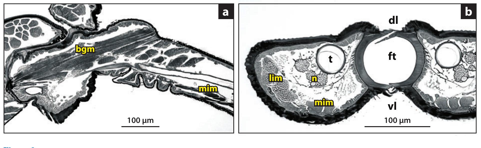 Proboscis anatomy of the butterfly vanessa cardui