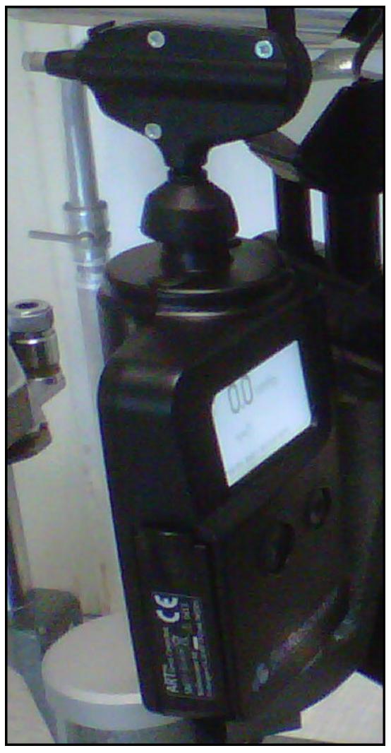 Figure 18 - How to Measure Intraocular Pressure: An Updated