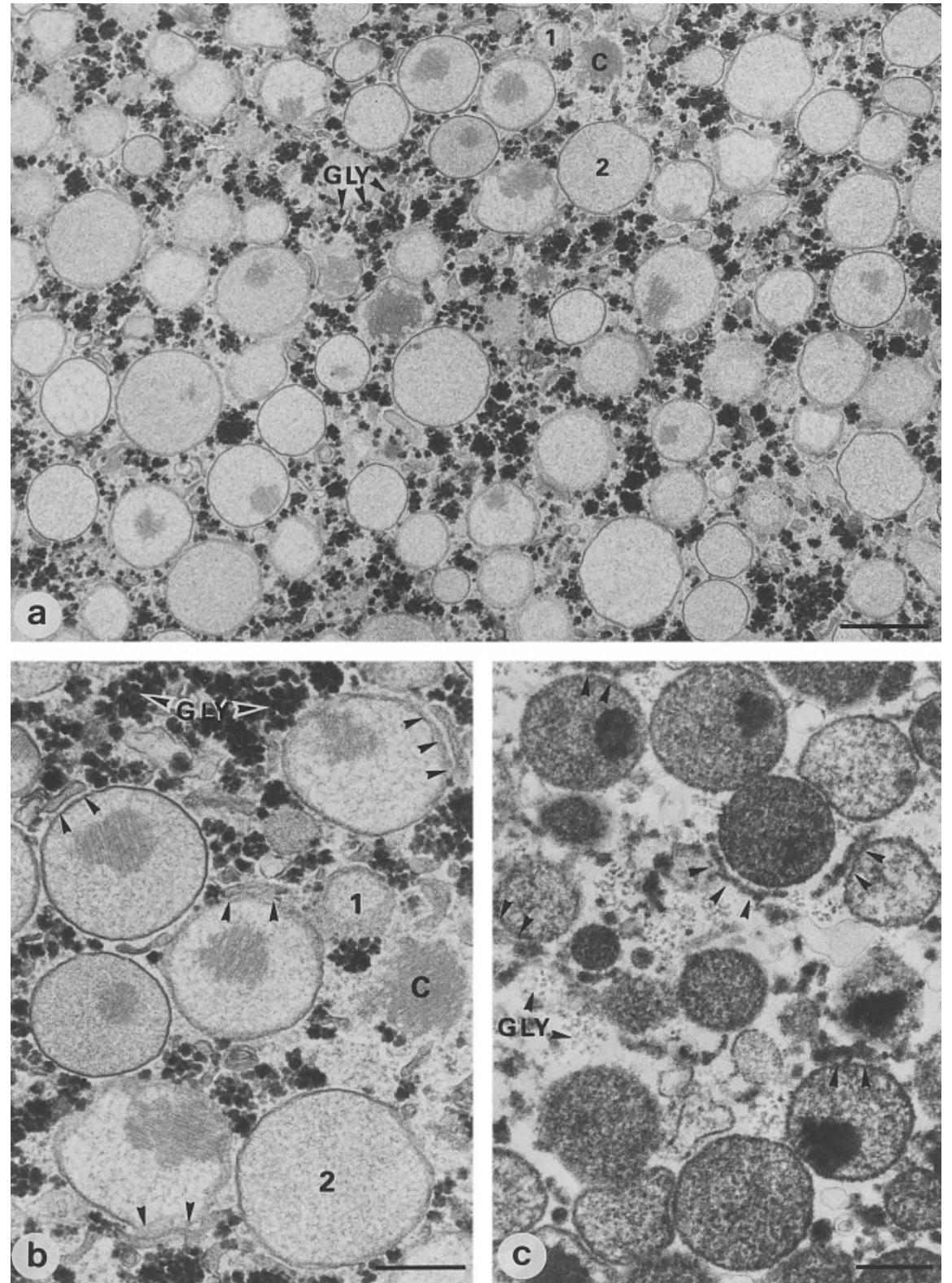Electron microscopy of peroxisomes purified by means of