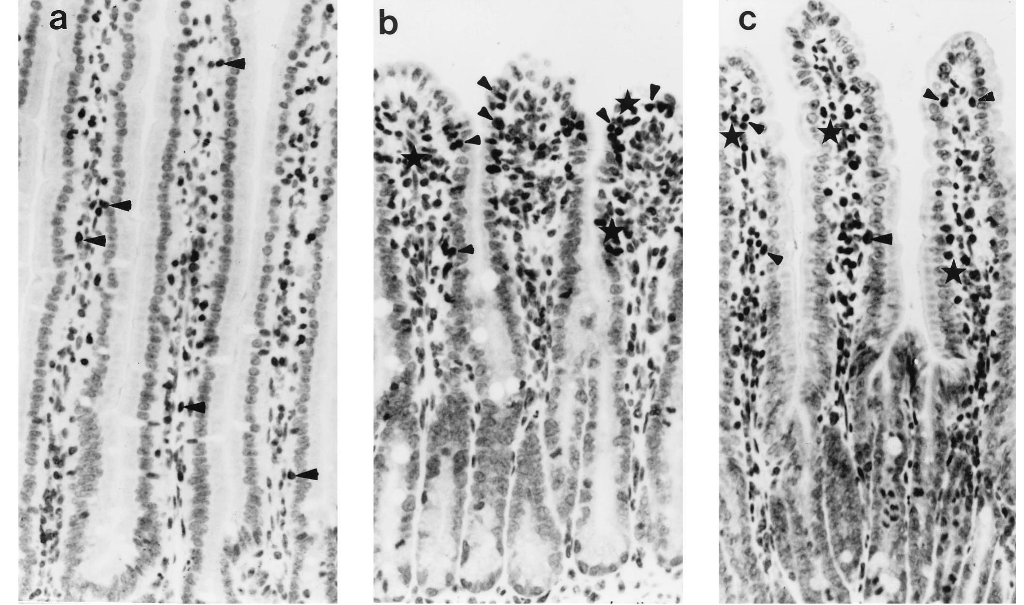 Photomicrographs showing immunostaining of cd3* t cells in