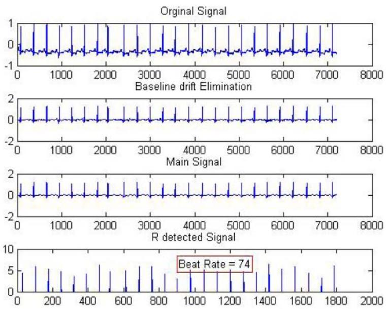 Ecg signal analysis flowchart