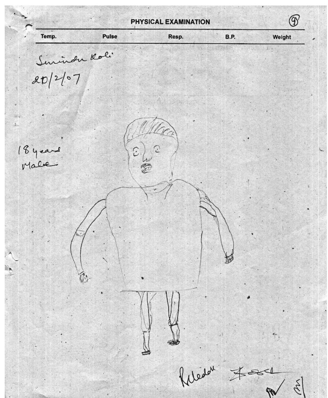 On the draw a person test, the male drawing.