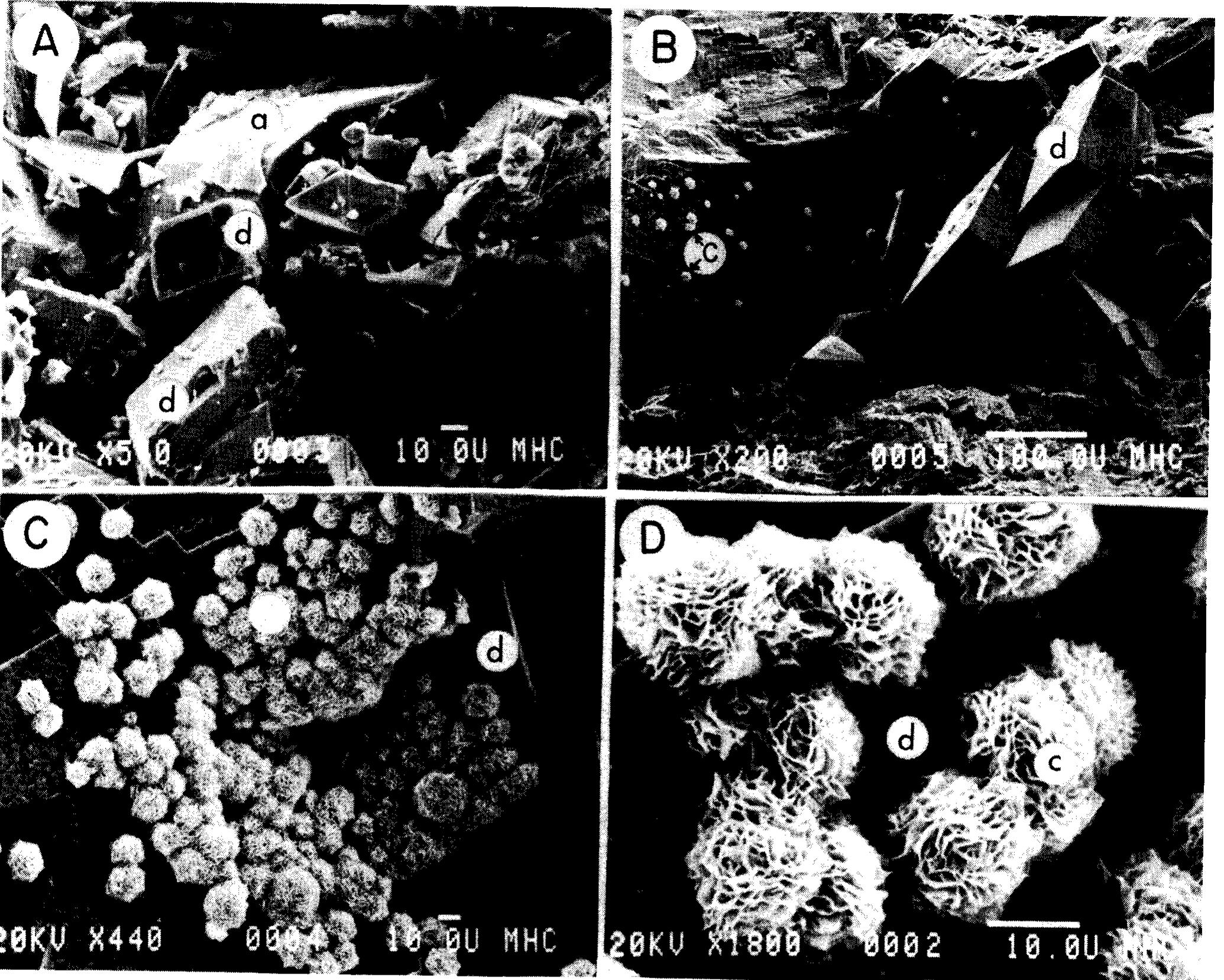 —scanning electron microscope images of an east berlin