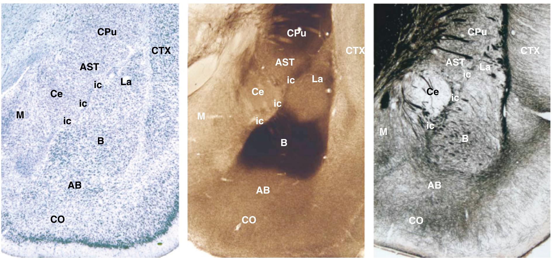 Key areas of the amygdala, as shown in the rat brain. the