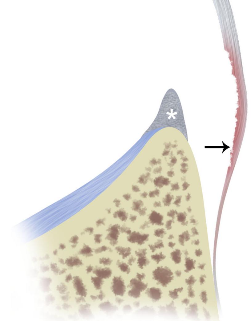 Illustration demonstrating the anterior ligamentous