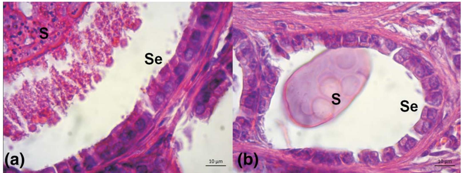 Sturnira erythromos: secretory epithelium of the glands of