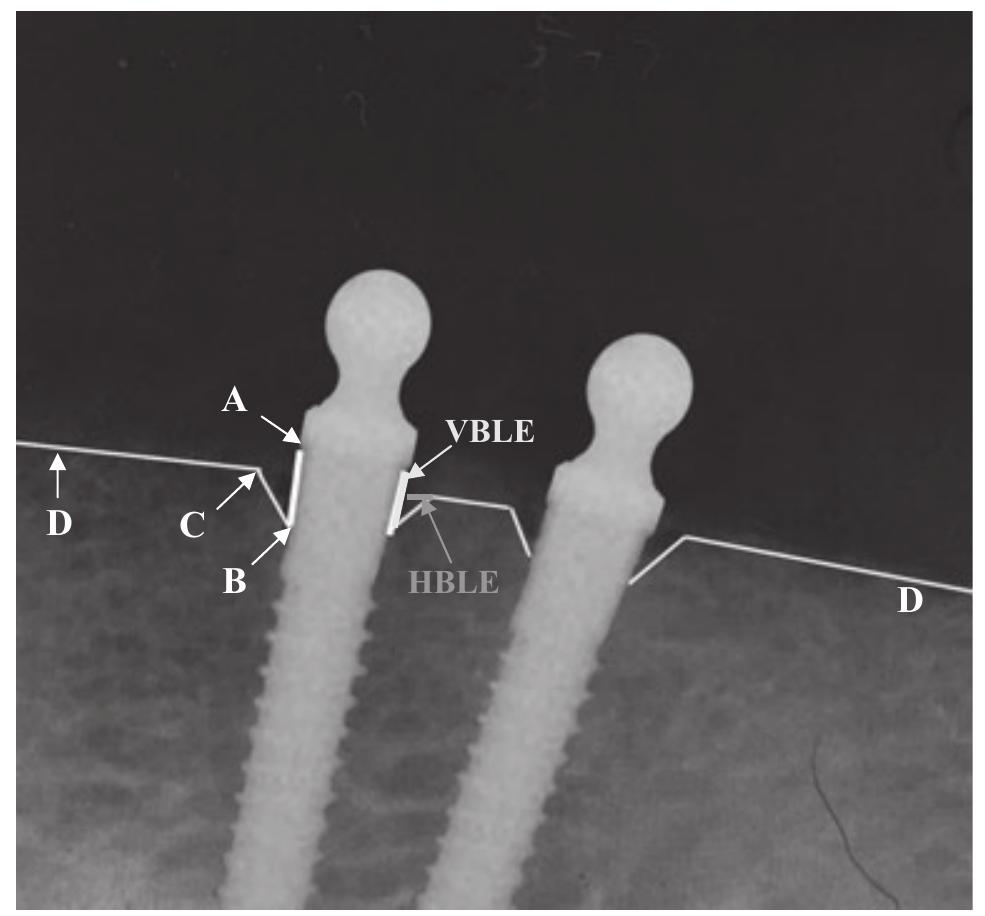 Traced periapical radiograph. peri-implant crestal alveolar