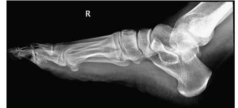 Lateral radiograph. the differential diagnosis of these