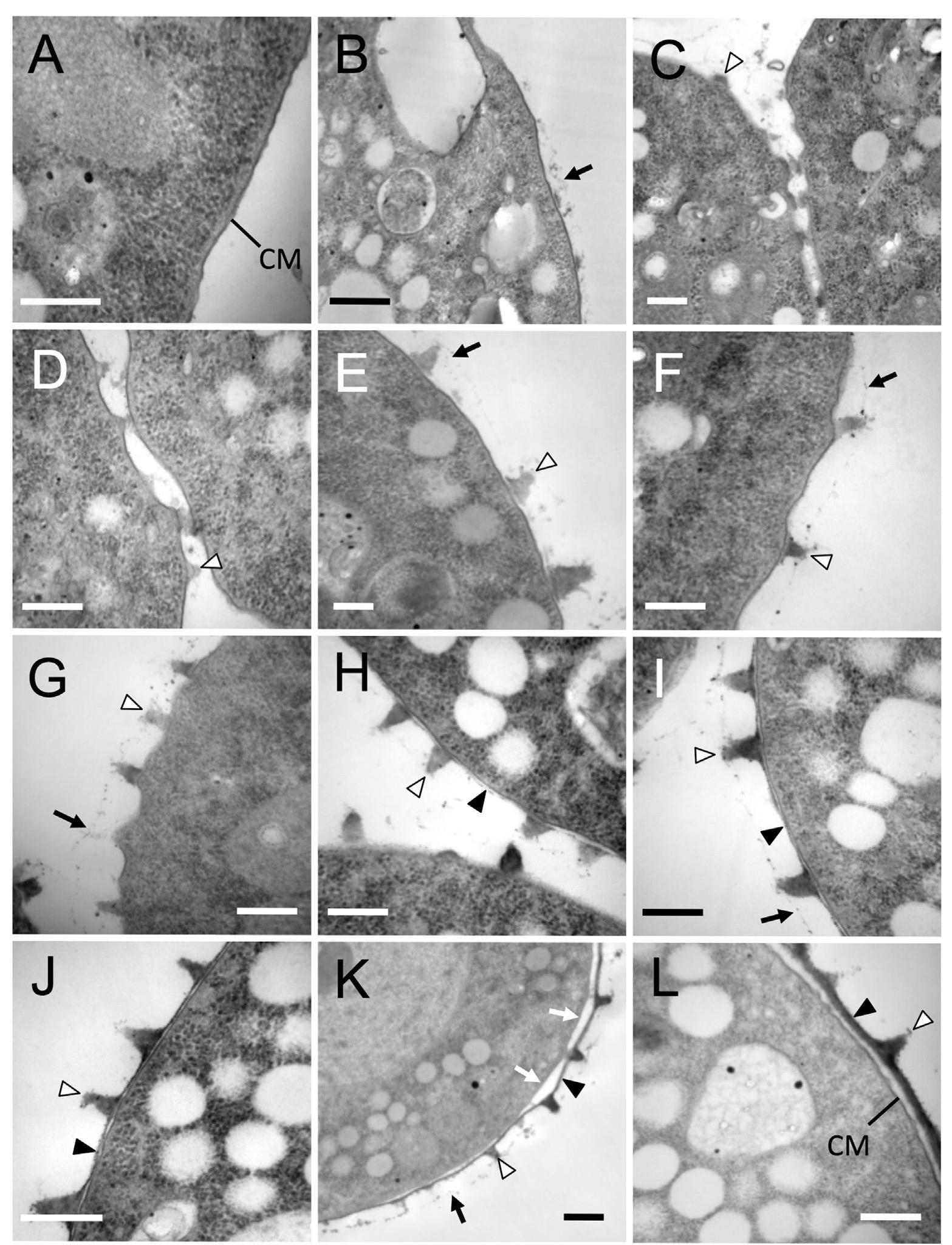 badhamia alpina (sapa 100015). a—l: formation of spore