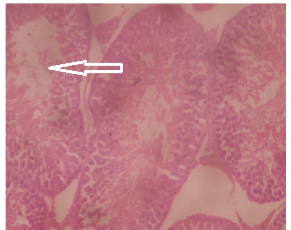 Photomicrograph of transverse section of typical testicular