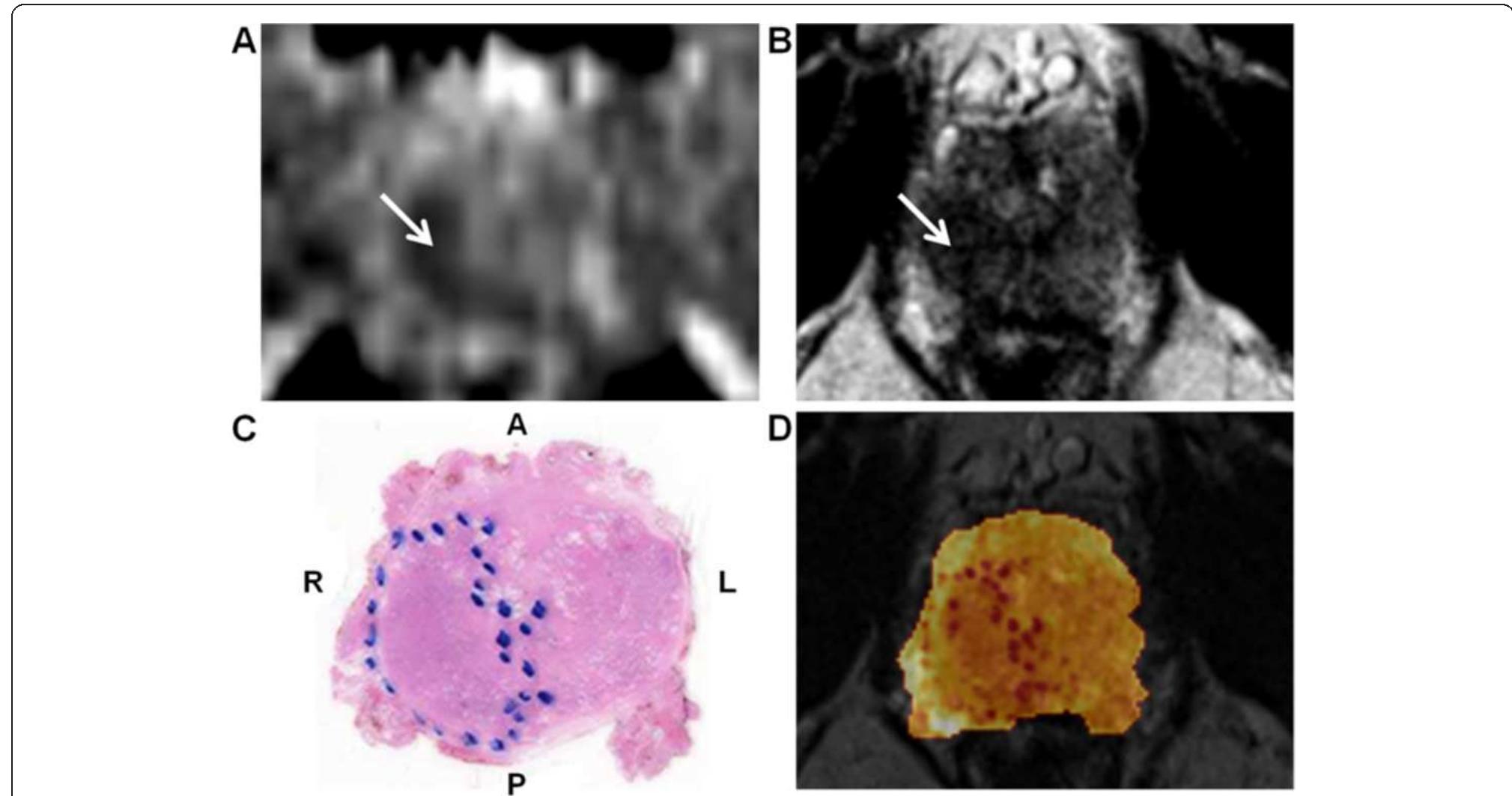 Coregistration of anatomical imaging and histology.