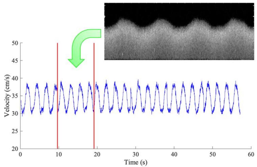 Example of the sinusoidal trend in lm; regime for gammex