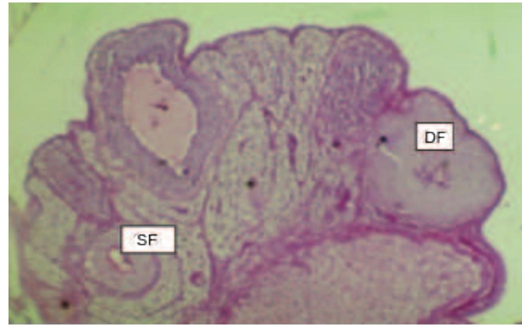 Low-dose treatment: ovarian sections show all types of