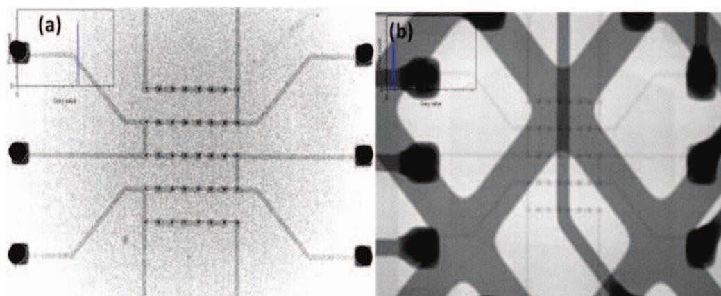 X-ray images of stacked structure (a)flip chip bonding on