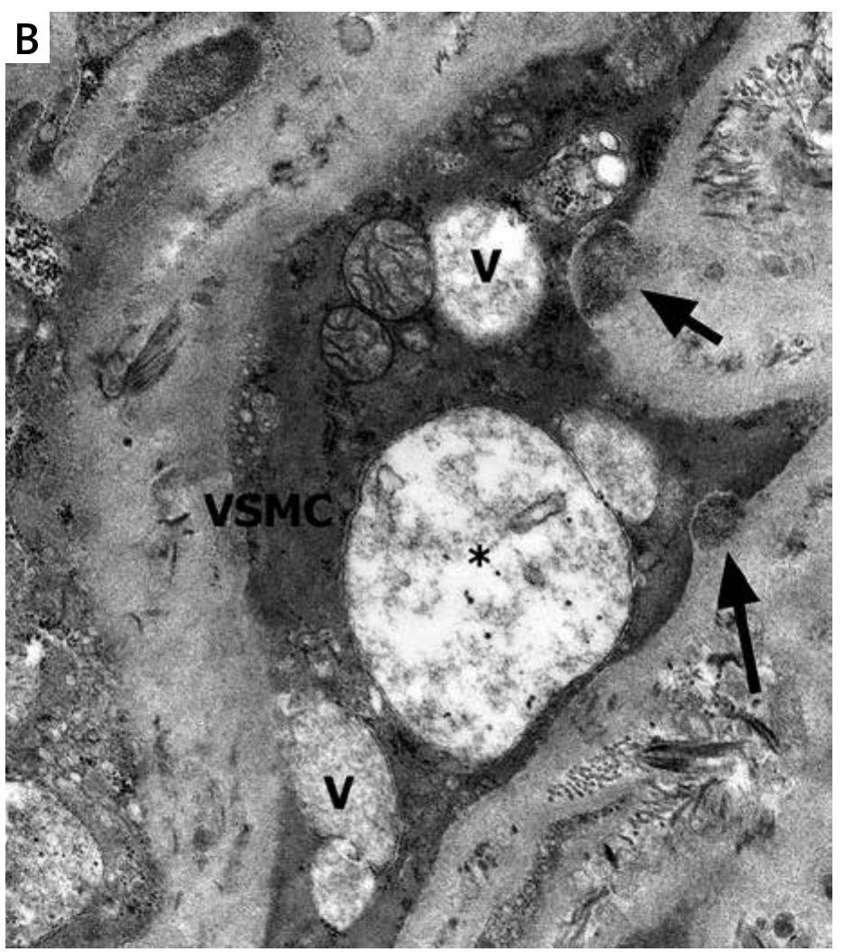 Light microscopic examination revealed granular deposits in